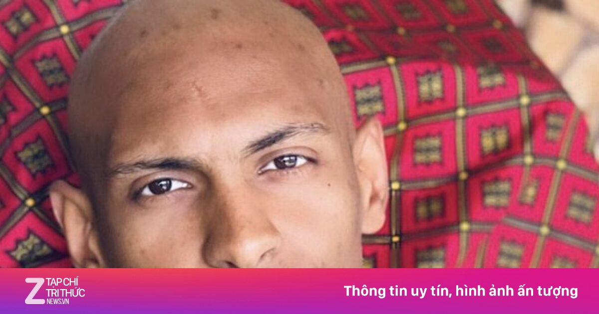 Hình ảnh mới nhất của Haller - Hậu trường - ZNEWS.VN