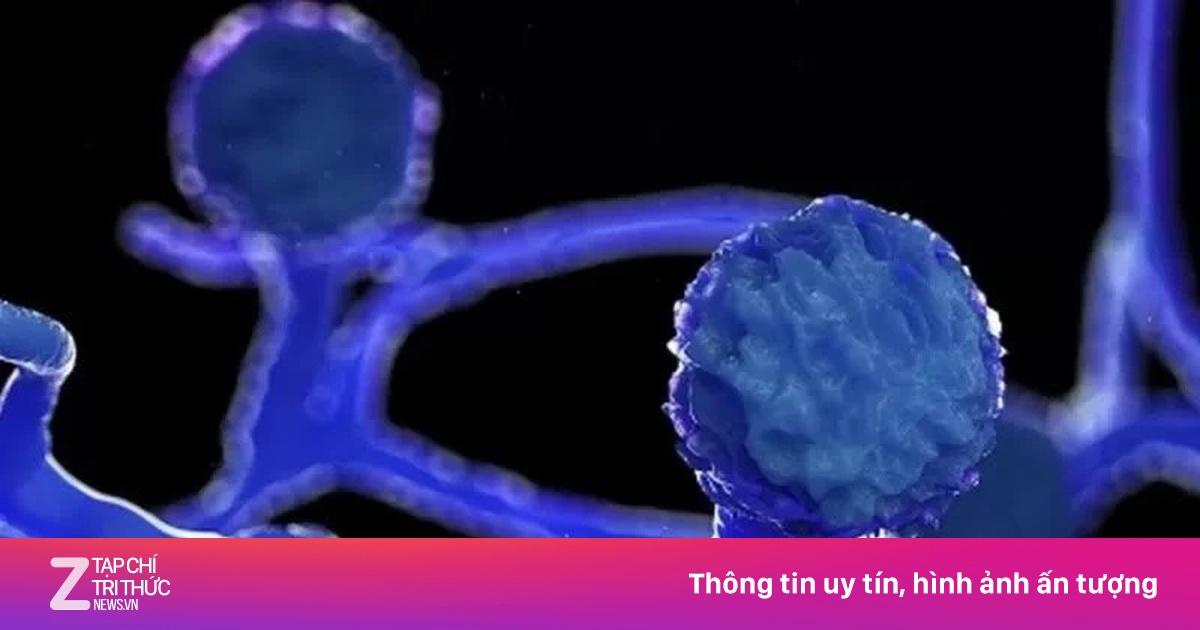 Đi khám suốt 3 tháng không ra bệnh vì mắc loại nấm nguy hiểm - Sức khỏe ...