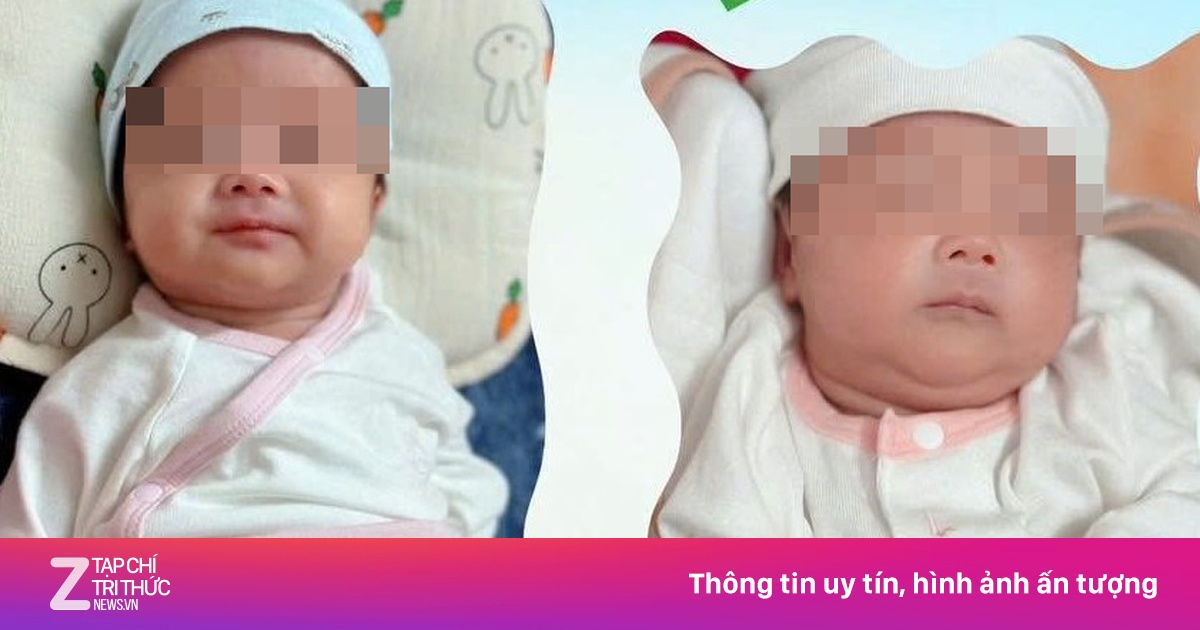 Hai bé song sinh chào đời cách nhau hơn một tháng - Sức khỏe - ZNEWS.VN