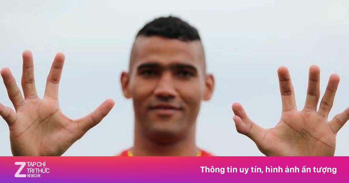 Thủ môn Brazil sở hữu bàn tay 6 ngón - Thể thao Thế giới - ZNEWS.VN