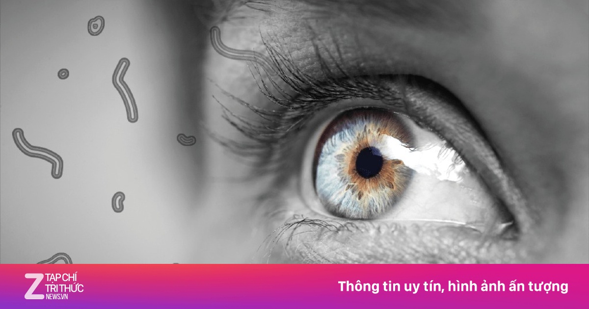 Hiện tượng 'ruồi bay' trước mắt là gì? - Giáo dục - ZNEWS.VN