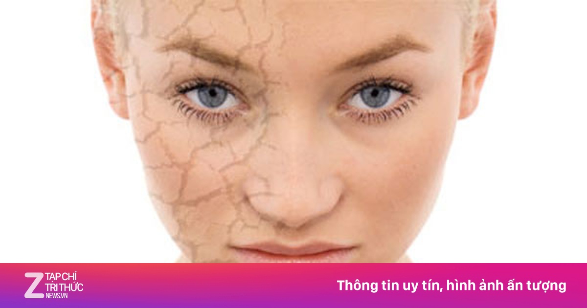 Uống soda có đường khiến lão hóa sớm - Sức khỏe - ZNEWS.VN