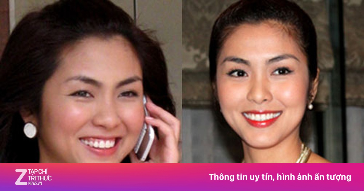 5 mỹ nhân tự 'giết chết' nụ cười tuyệt đẹp trời ban - Đời sống Sao - ZNEWS.VN