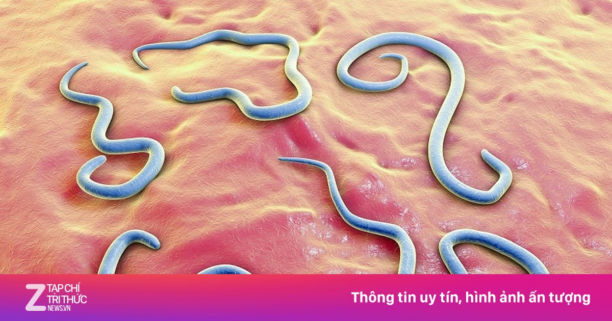 Người lớn nên tẩy giun bao lâu một lần? | Znews.vn
