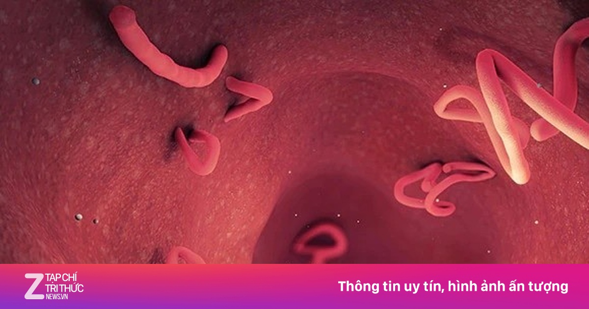 Dấu hiệu cảnh báo bạn nhiễm giun sán - Sức khỏe - ZNEWS.VN