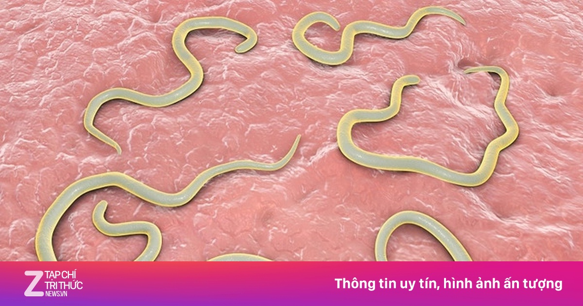 Điều không nên làm khi bị nhiễm giun - Sức khỏe - ZNEWS.VN