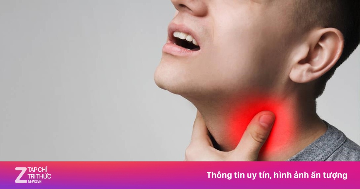 Quai bị là bệnh gì? | Znews.vn