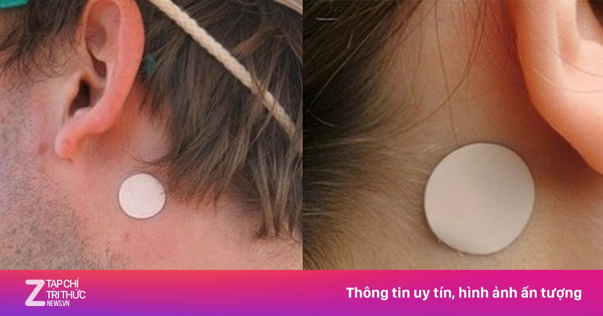 Lưu ý khi dùng miếng dán chống say xe - Sức khỏe - ZNEWS.VN