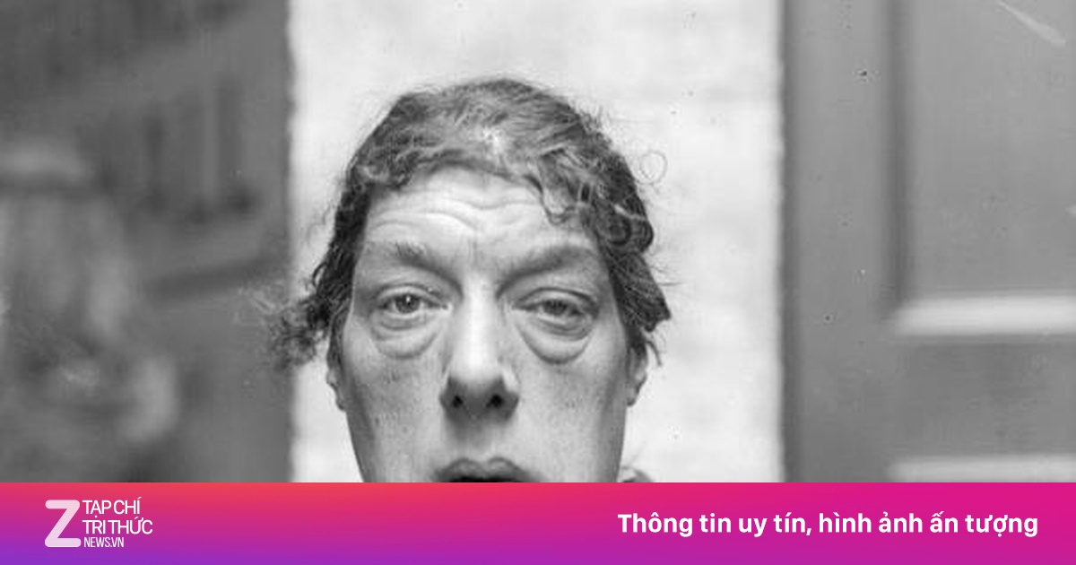 Người phụ nữ xấu nhất thế giới bán 'nhan sắc' để nuôi 4 đứa con | Znews.vn