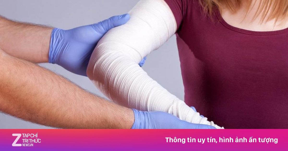 Cách sơ cứu khi bị bỏng axit bạn cần nhớ - Bệnh thường gặp - ZNEWS.VN