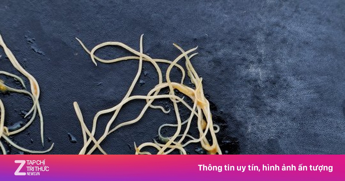 Ai có nguy cơ nhiễm giun kim cao nhất? - Sức khỏe - ZNEWS.VN