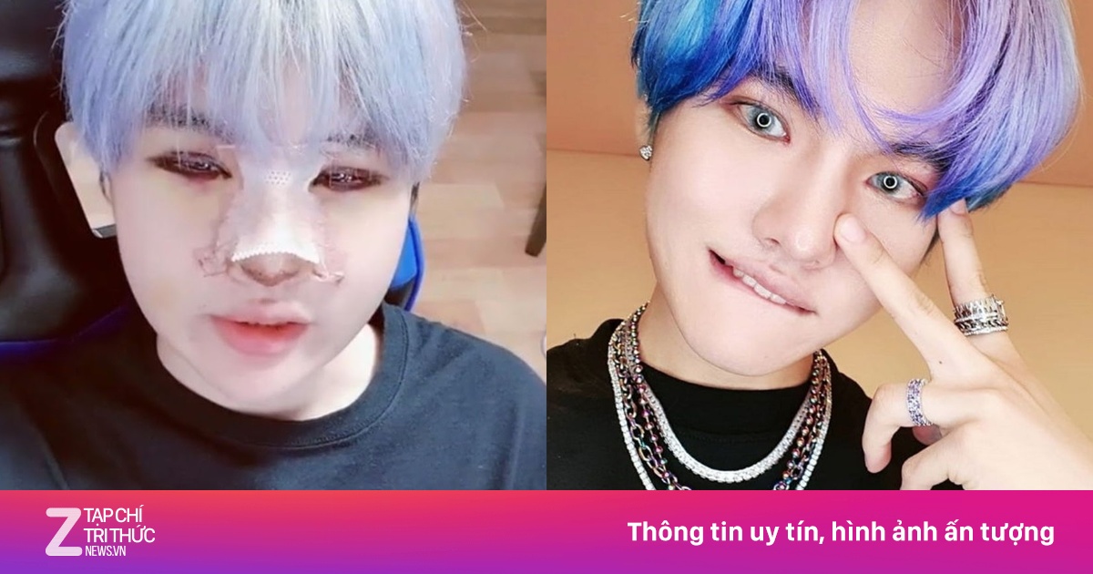 Rapper Hàn đăng ảnh băng bó mặt, thừa nhận 'dao kéo' vì bị miệt thị ...