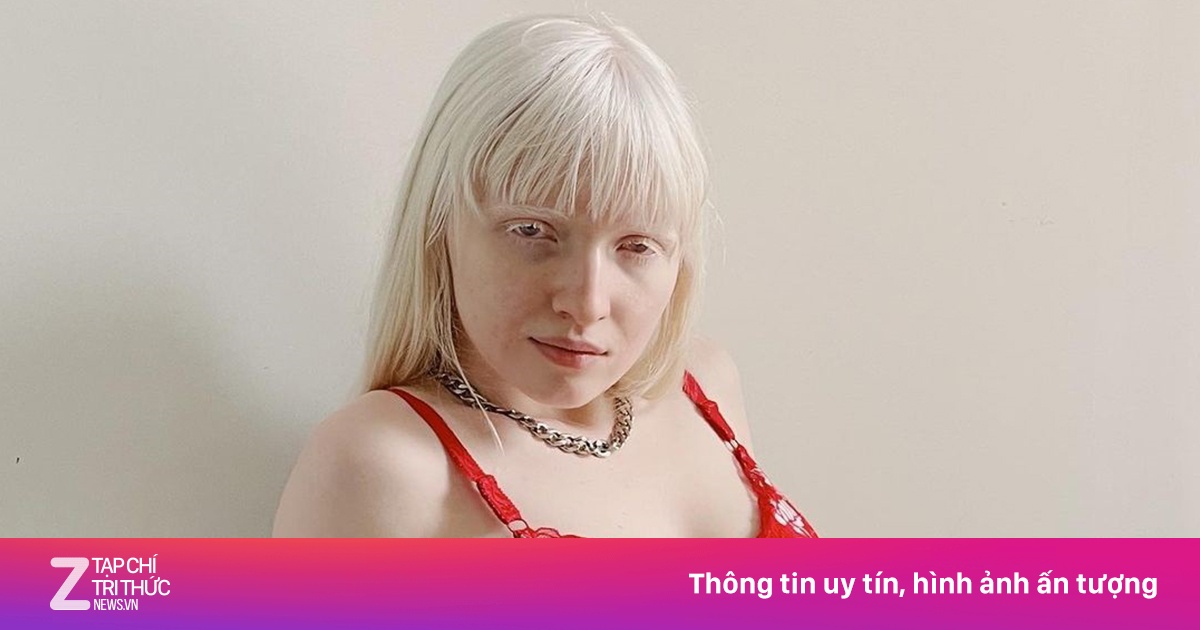 Những người mẫu bạch tạng phá vỡ tiêu chuẩn sắc đẹp - Mặc đẹp - ZNEWS.VN