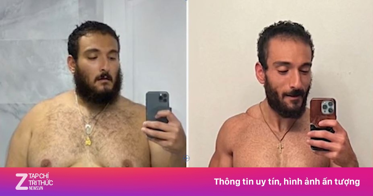 Chàng trai giảm hơn 80 kg trong 2 năm - Đời sống - ZNEWS.VN