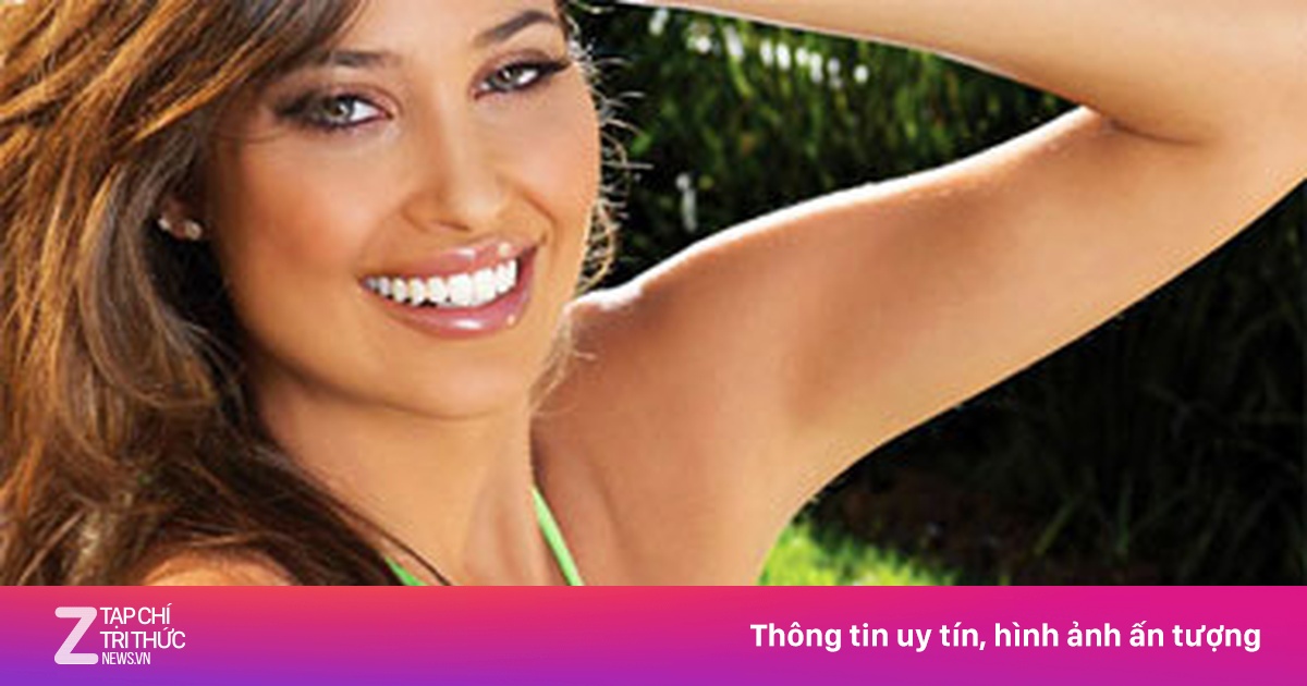 Nàng 'Heidi mới' của Brazil - Mặc đẹp - ZNEWS.VN